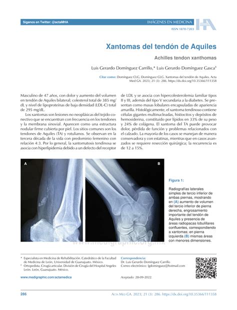 Pdfmx ImÁgenes En Medicina Xantomas Del Tendón