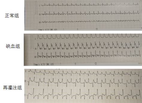 大（小）鼠心肌缺血再灌注模型 Myocardial Ischemia Reperfusion 中洪博元商城疾病动物模型实验动物动物实验物资