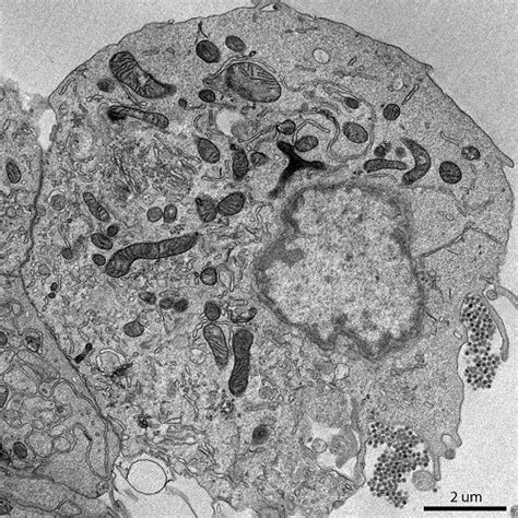 24 Best Images About Transmission Electron Microscopy On Pinterest