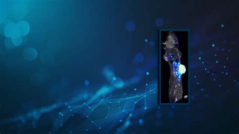 Hypoxia In The Tumor Immune Microenvironment Time Bruker