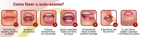 Auto Exame Bucal Odonto Saúde Spa