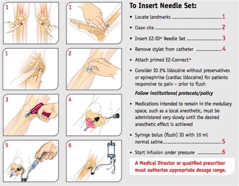 Intraosseous Io Access Manual Of Medicine