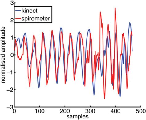 Respiratory Rate Detection Algorithm Based On Rgb‐d Camera Theoretical