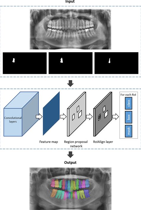 Application Of A Fully Deep Convolutional Neural Network To The Automation Of Tooth Segmentation