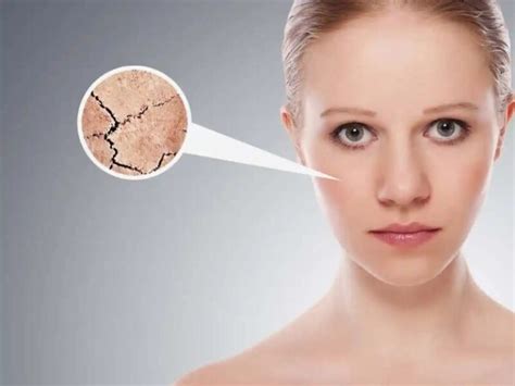 Does Vaseline Clog Pores What Dermatologists Say Igxo Cosmetics