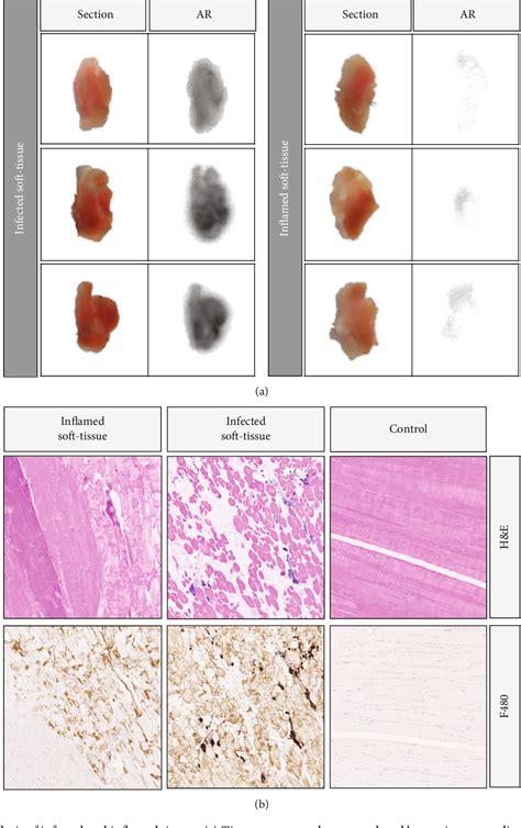 Figure 3 From In Vivo Detection Of Staphylococcus Aureus Infections
