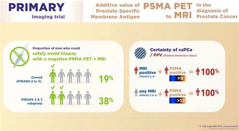 Combining Mri And Psma Pet Scans For Prostate Cancer Patients Prokar