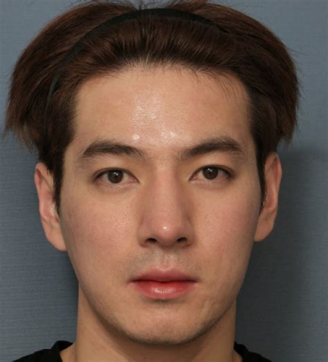 아름다움에 날개를 나비성형외과