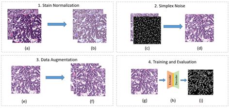 NucleiSeg In Histopathology Images Official Implemenation Paper Published At MIDL