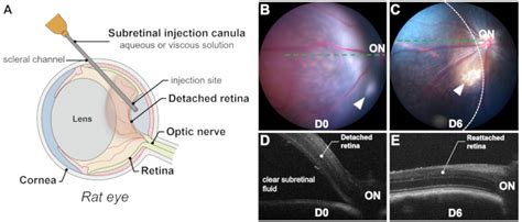 Intraoperative Visualization Of Subretinal Injection And Retinal Detachment In Rats