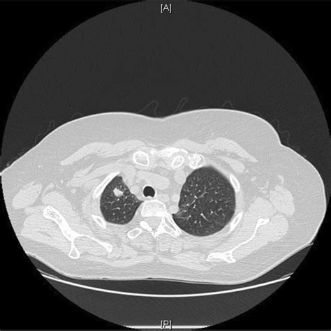 Longitudinal Section Of D Repens Download Scientific Diagram