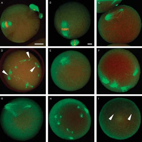 Preparation Of Cytoplasts From Gv Mi And Mii Stage Mouse Oocytes A