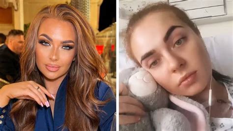 Demi Jones Says Love Island Fans Helped Her Get Her Cancer Diagnosed