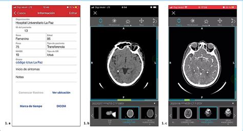Figure 1 From The Use Of A Smartphone Application To Improve Stroke Code Workflow Metrics A
