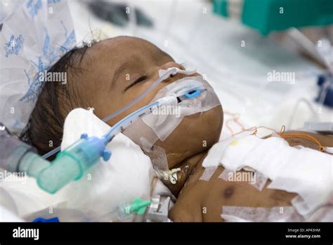 Un Enfant Reçoit Un Traitement Dans Lunité Des Soins Intensifs