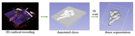 【论文】3d U Net Learning Dense Volumetric Segmentation From Sparse