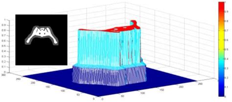 figure 1 from segmentation of bone from adc maps in pelvis area using