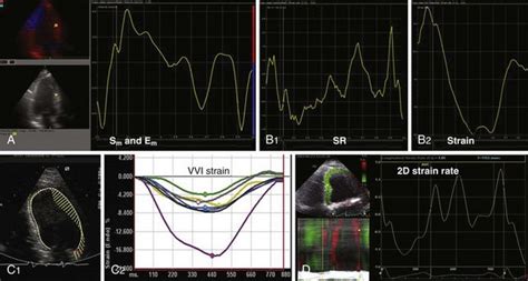 Strain And Strain Rate Imaging Thoracic Key