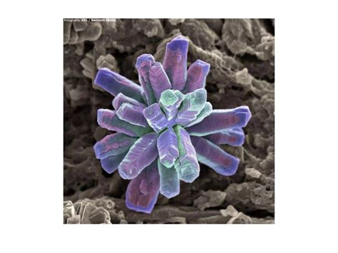 Matriz Osea Extracelular Pptx Bone And Joint Conditions Diseases And Conditions