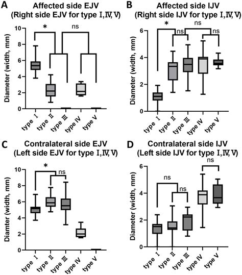 Frontiers Anatomical Variations Of The External Jugular Veins And Collaterals Incidentally
