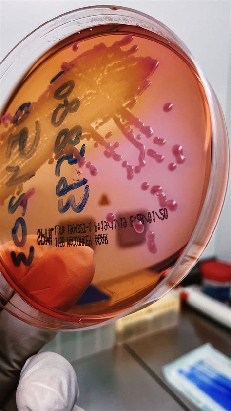 Enterobacter Cloacae Emb