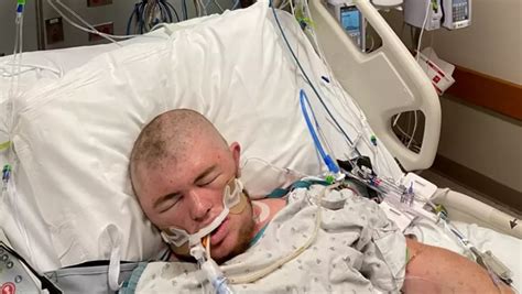 Us News Man In Agony After Being Stung By Bees 20000 Times News