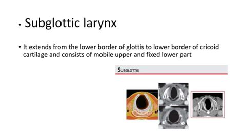 Clinical Anatomy Of Laryngeal Cancerppt