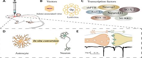 Neural Regeneration Research