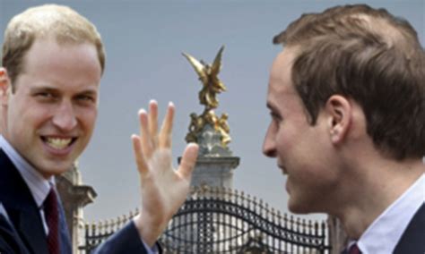 Royal Wedding Cure For Royal Baldness Resurfaces Too Late For Prince