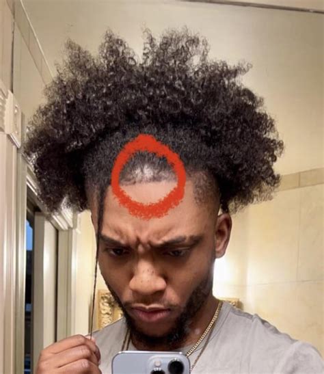 Is Josh Balding Bc This Dont Look Like A Part To Me R Yourrage