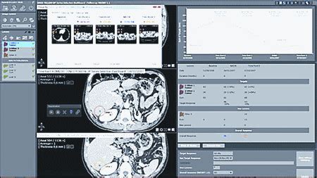 Myrian XL Onco The Solution For Oncology Follow Up Trade Trends News The Financial Express
