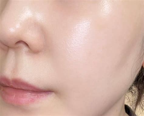 압구정로데오역 피부과 스킨부스터 릴리이드m 물광주사 후기 네이버 블로그