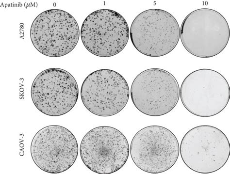 Apatinib Suppressed Growth Of Oc Cells A Cell Viability Assays Of