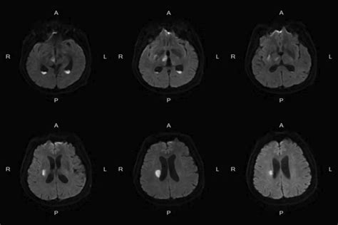 Brain Cranial Enhanced Magnetic Resonance Imaging Download Scientific