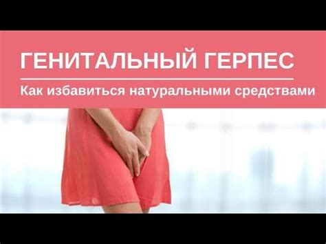 Генитальный герпес. Как избавиться натуральными средствами - YouTube