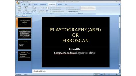 Arfi Fibroscan Elastography Youtube