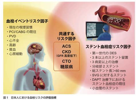 Pci後のdaptはどのくらい続けるの？ Kusuripro くすりがわかる！薬剤師ブログ