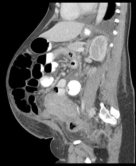 Pin On Gastrointestinal