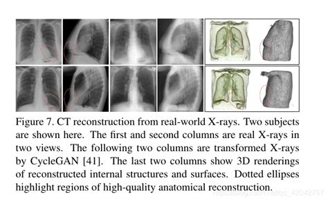 论文阅读reconstructing Ct From Biplanar X Rays With Generative Adversarial Networksx2ct Gan