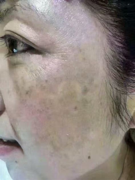 48歲大媽30秒淡斑美白，卻只用了生薑恢復嬰兒肌 每日頭條