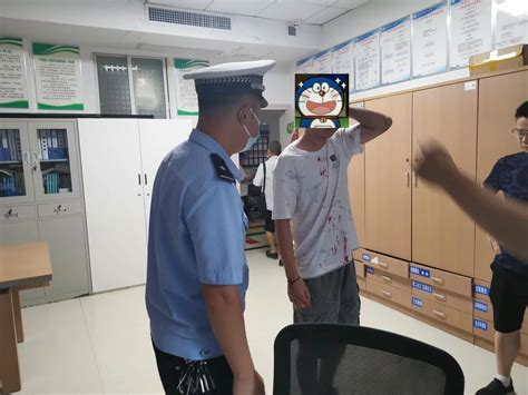 男子踏空台阶摔倒，头部鲜血直流！泸溪交警3分钟送至医院高考姜敏警笛