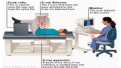Dexa And Its Aplication Pptx Bone And Joint Conditions Diseases And Conditions