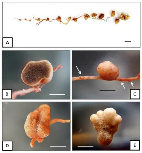 Nodules Morphology A Developmental Stages Of Nodules Collected From