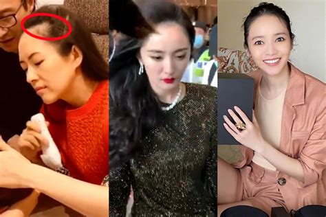 一夜老10歲！章子怡「禿頭掉髮」登熱搜，專家曝：掌握「黃金代謝期」都有救女人我最大