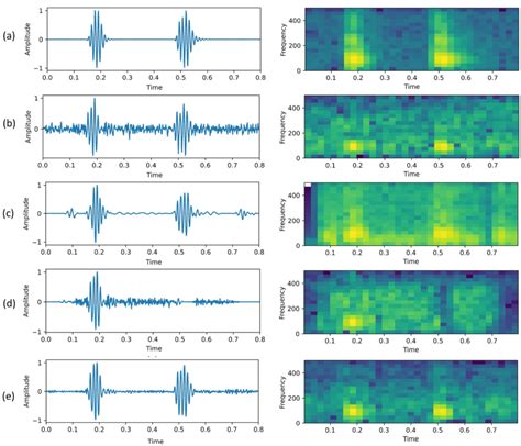 Waveforms And Spectrograms Of A Typical Normal Pcg Signal A Original