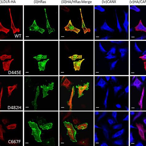 Comparison Of Intracellular Localization Of Ldlr Wild‐type And Mutant