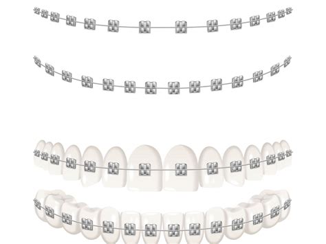 Braces And Speech Improvement How Orthodontics Can Help Liberty Dentist Tx