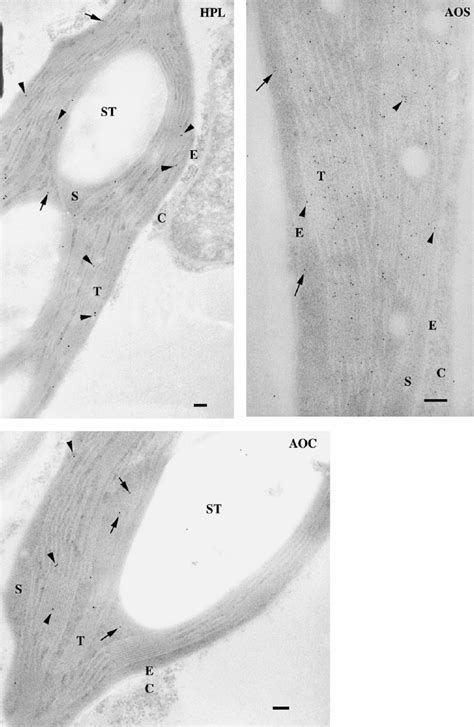 Electron Microscopy Of Lipoxygenase Pathway Proteins Localization Of