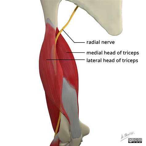 Radiopaedia Drawing Radial Nerve At Humerus Posterior View English