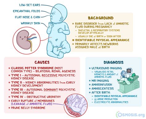 Potter Syndrome What Is It Causes Treatment Osmosis